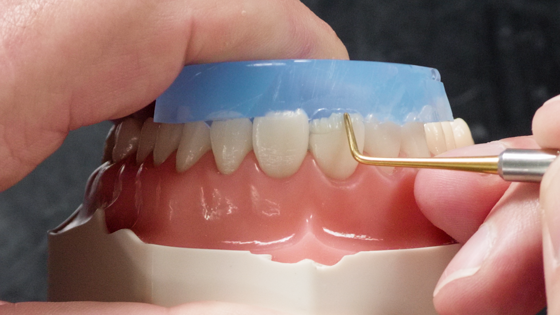 Dentin Replacement | Spear Education