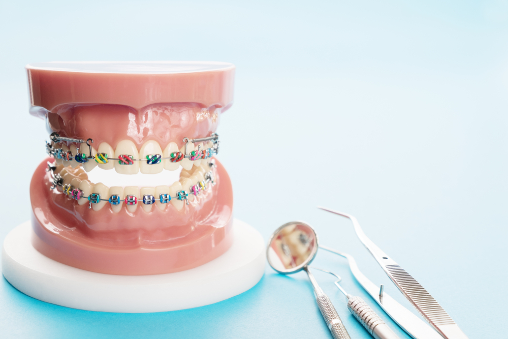 Ortho vs. Restorative to Correct Malaligned Teeth - Six Key Questions ... Ortho vs. Restorative to Correct Malaligned Teeth - Six Key Questions ...