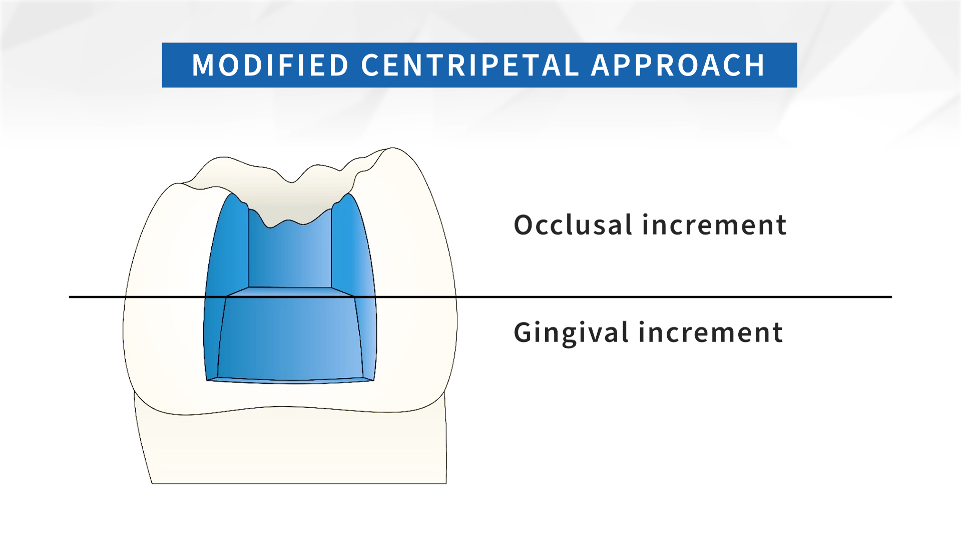 The Class II Box: Closing the Box, Part 1 | Spear Education