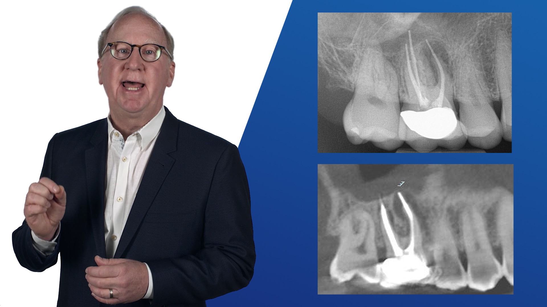 Perforation Detection | Spear Education