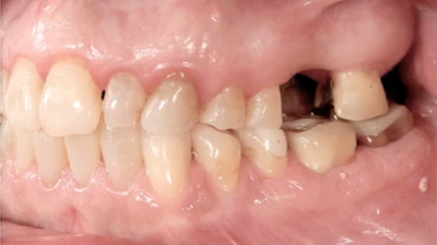 Unusual Patterns of Wear | Spear Education