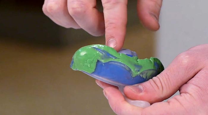 Making Accurate Dental Models | Spear Education