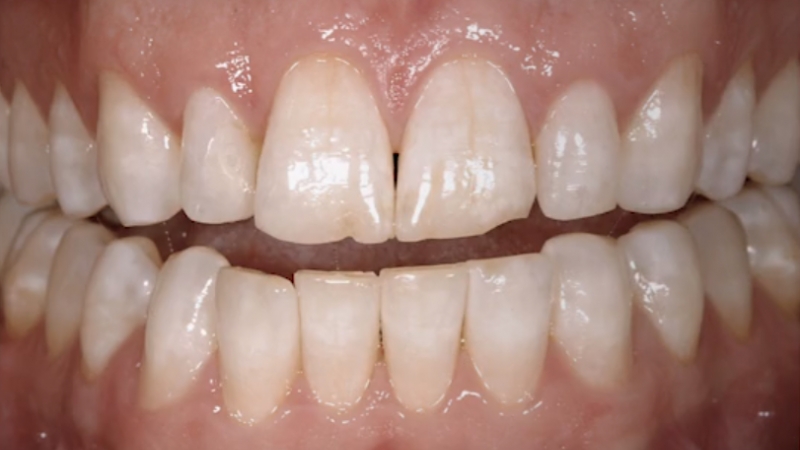 Managing Occlusion in Clinical Practice | Spear Education