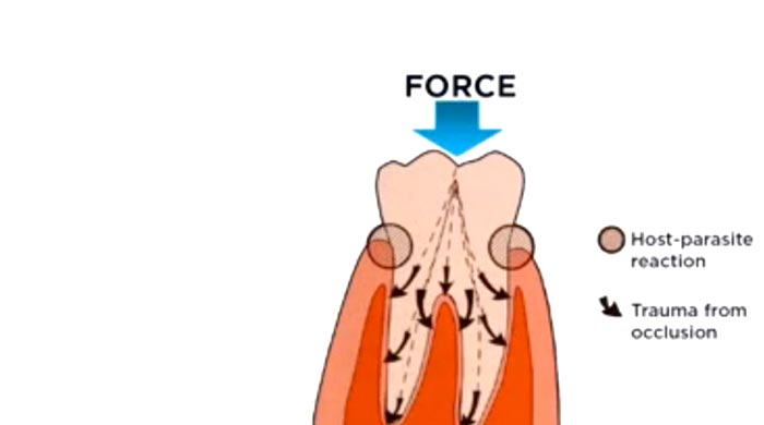 Relationship Between Occlusion and Muscles | Spear Education
