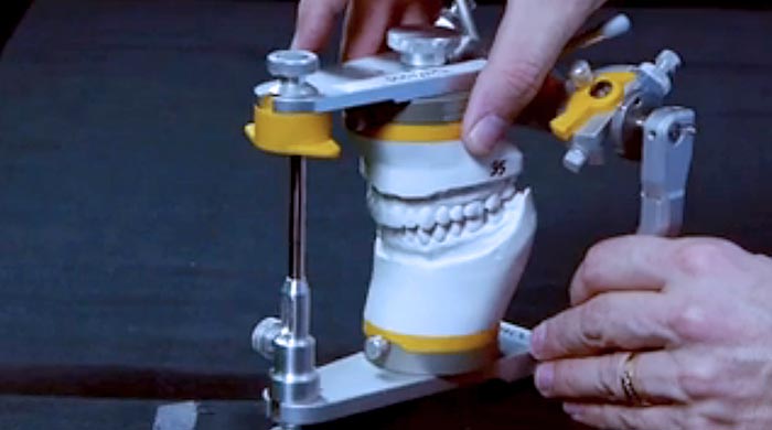 Understanding SAM III Articulators and Facebows | Spear Education
