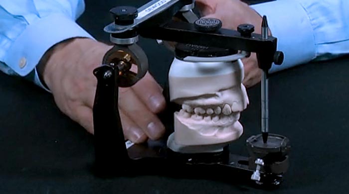 Mounting the Lower Model on the Hanau Wide View Articulator | Spear ...