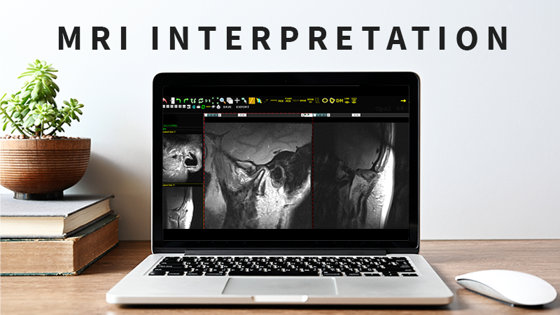 MRI Post-Processing: The Key to MRI Interpretation | Spear Education